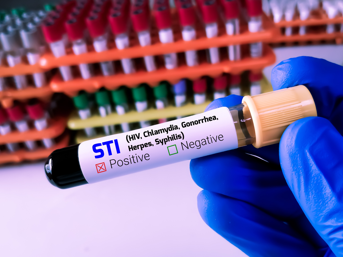 STIs on the Rise: What You Need To Know - WWMG Blog